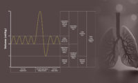 What is the Role of Heated and Humidified High Flow Oxygen In ...