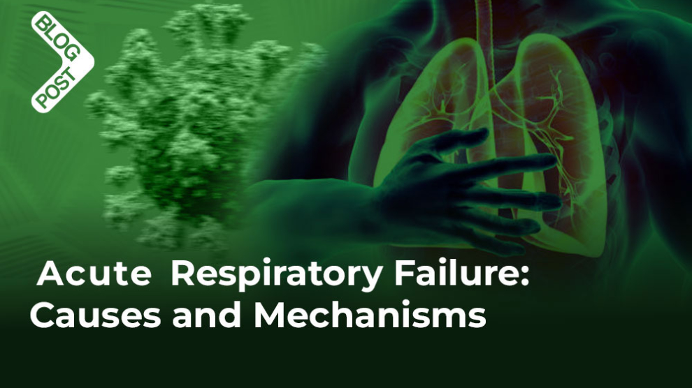 Acute Respiratory Failure: Causes and Mechanisms - Biosys